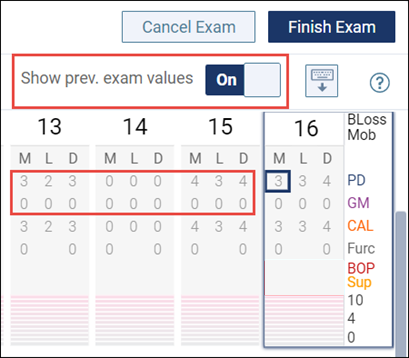 Creating a New Perio Exam with Just the Changes from the Last Exam ...