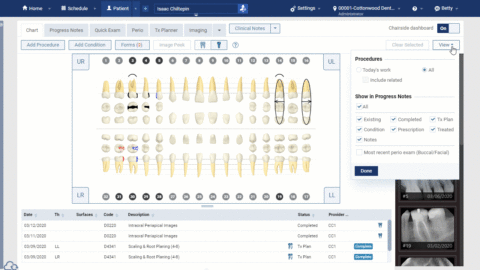 Using the Chairside Dashboard | Dentrix Ascend