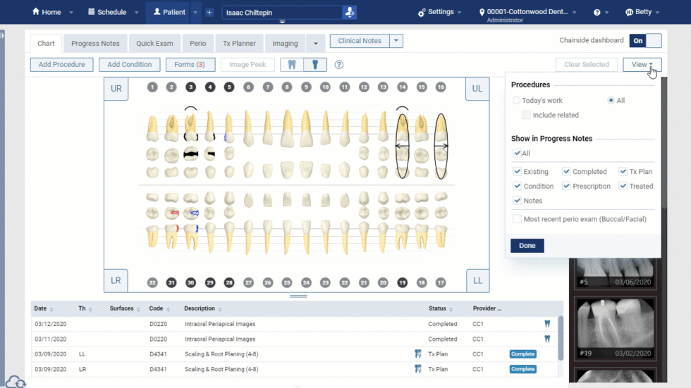 Using the Chairside Dashboard | Dentrix Ascend