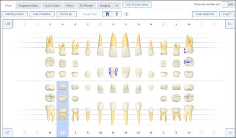 Charting Supernumerary Teeth | Dentrix Ascend