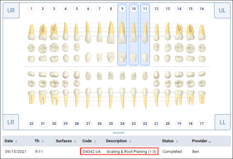 Handling a Carrier Request for A Range of Teeth as the Treatment Area ...