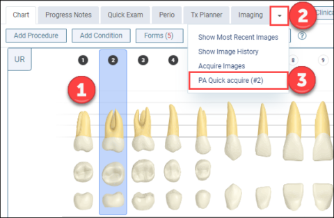 Acquiring an Image from the Patient Chart and Quick Exam | Dentrix Ascend