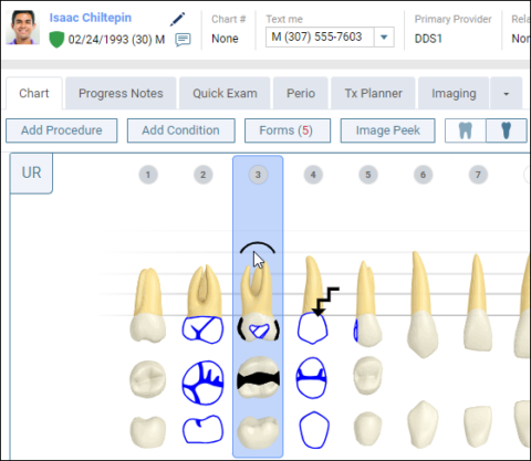 Shortcut to Tooth History | Dentrix Ascend